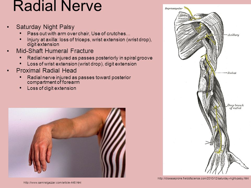 Humerus Fracture Physiotherapy